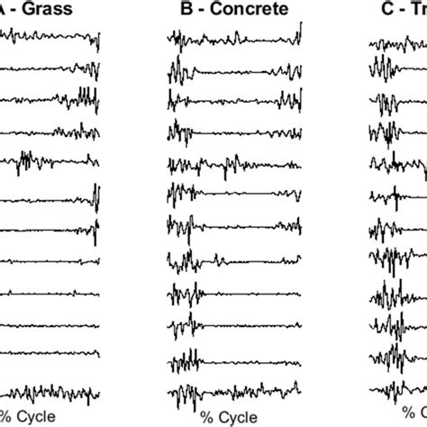 Illustration Sample Of Raw Surface Emg Signals From One Participant