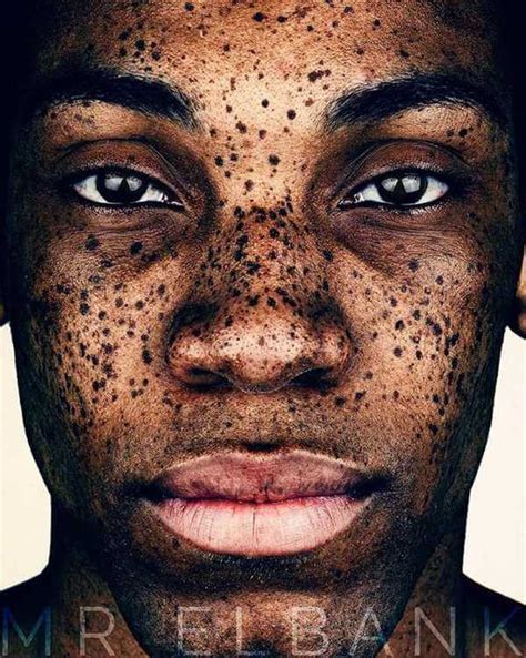 Amazing Portraits That Prove Freckles Are Beautiful