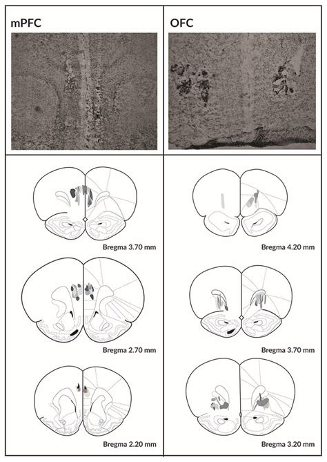 Orbitofrontaler Cortex