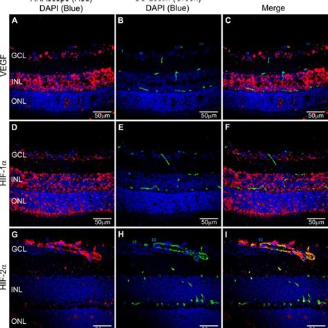 Overview Of The Protocol For Combined In Situ Hybridization And