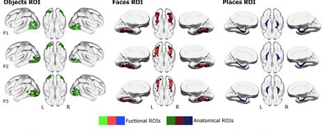 Figure 2 From The Role Of Ventral Stream Areas For Viewpoint Invariant