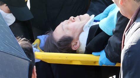 South Korean Opposition Leader Stabbed In The Neck Expected To Recover