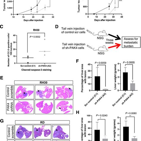 Transcriptomic Analysis Of KPT 9274 Treated RMS Tumors A Volcano Plot