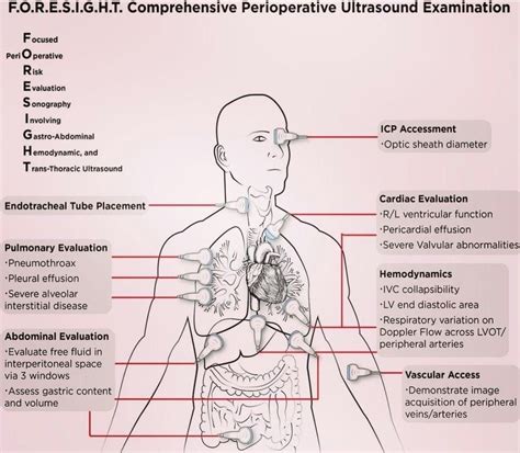 Andrea Glotta Posted On Linkedin