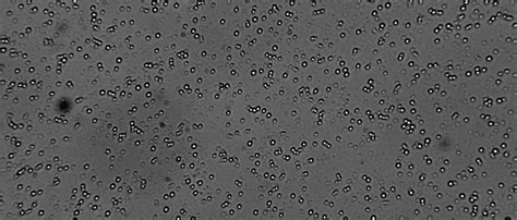Globule Size Determination For Semi‑solid Dosage Forms