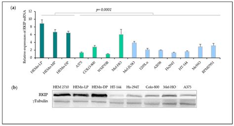 Rkip Expression In Cell Culture Of Primary Melanocytes And Melanomas Download Scientific