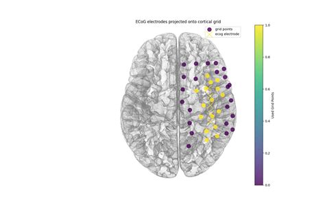 Grid Point Projection Py Neuromodulation Documentation