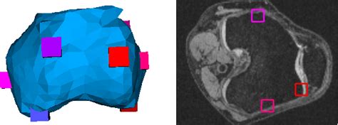 Figure 1 From Automated Anatomical Landmark Detection Ondistal Femur Surface Using Convolutional