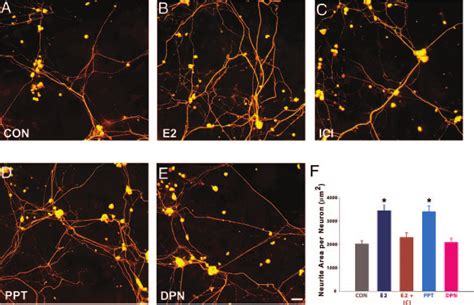 E2 Induced Neuritogenesis By Peripherin Immunostained Drg Neurons Is