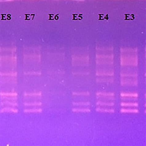 Gel Image Of Start Codon Targeted Bands Amplified With Primer 11