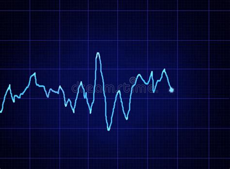 Ecg Graph Stock Illustration Illustration Of Line Blue 32263090