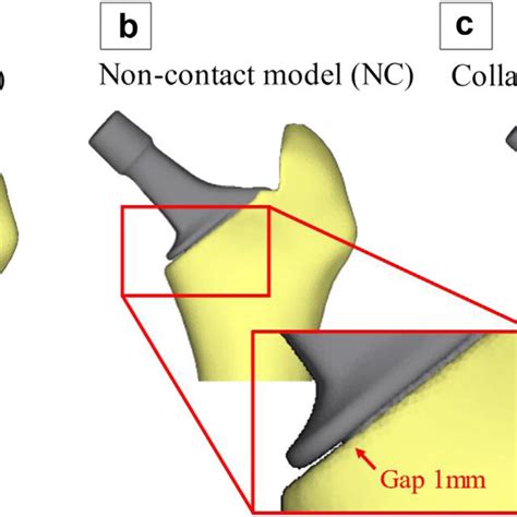 Three Finite Element Models A The Contact Model Was In Contact