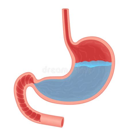 Acid Reflux Stock Vector Illustration Of Acid Esophageal 22706773