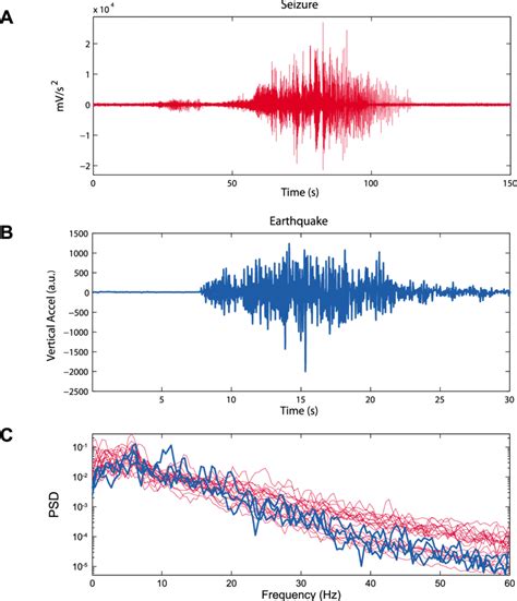 Color Online A Human Electrocorticogram Recorded Directly From The Download Scientific Diagram