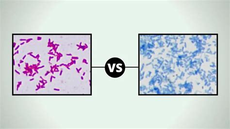 Comparison Between Acid Fast And Non Acid Fast Bacteria Biology Notes