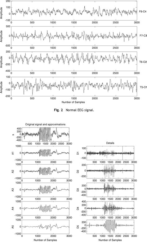 Figure 3 From Classification Of Eeg Signals Using Neural Network And