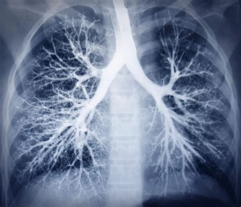 Better Breathing