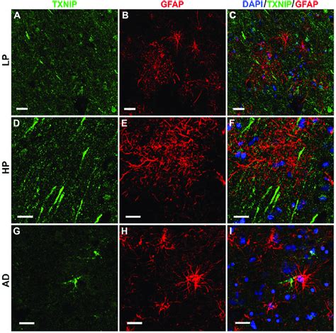 Confocal Microscopy Showing Limited Colocalization Of Txnip With