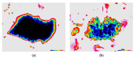Quantitative Structural Analysis Of Hyperchromatic Crowded Cell Groups In Cervical Cytology
