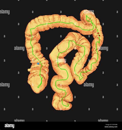 3D Computed Tomography CT Scan Of The Colon Stock Photo Alamy