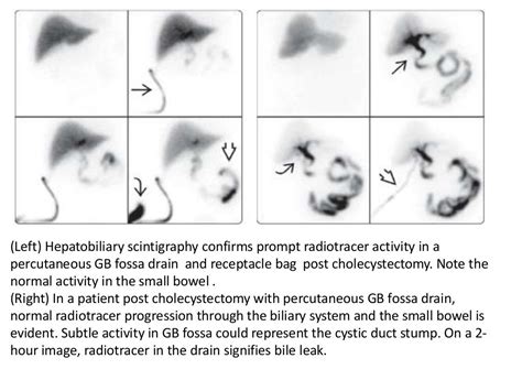 Hida Scan