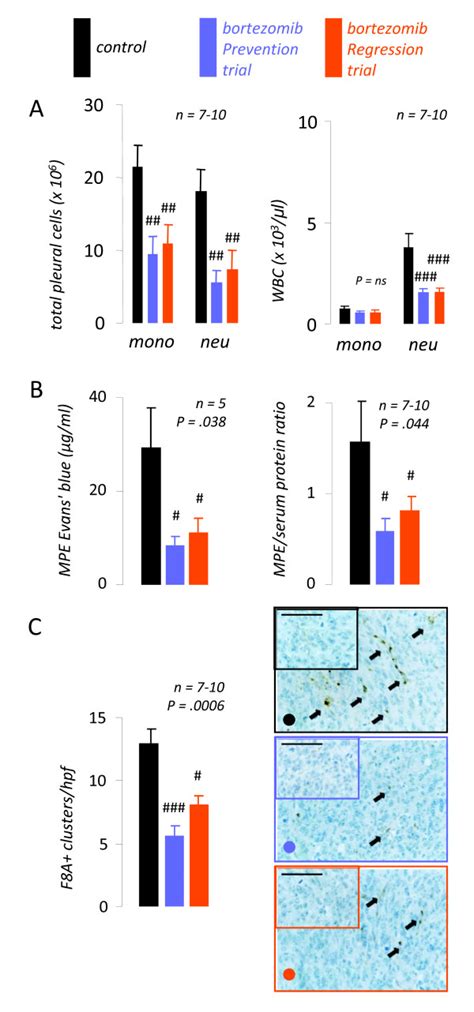 Nf κb Targeted Bortezomib Inhibits Malignant Pleural Effusion