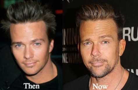 Sean Patrick Flanery Plastic Surgery Before And After Photos Latest