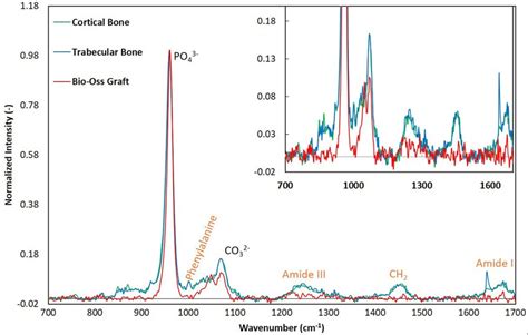 Evaluation Of Near Infrared Raman Spectroscopy In The Differentiation