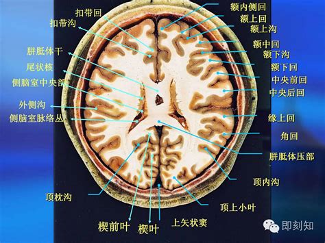 大脑冠状切面解剖图 头部冠状面 3 伤感说说吧