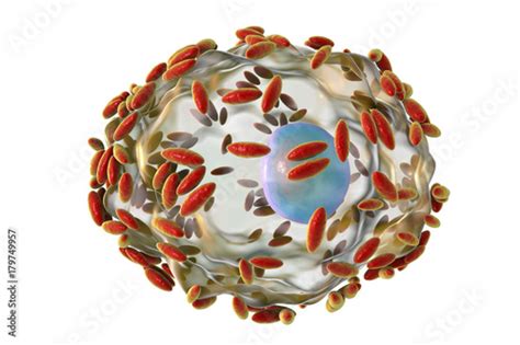 Microscopic Diagnosis Of Bacterial Vaginosis Vaginal Secretions