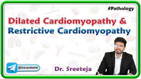 10 Dilated Cardiomyopathy And Restrictive Cardiomyopathy Pathology