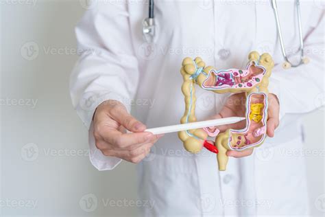 Doctor Holding Human Colon Anatomy Model Colonic Disease Large