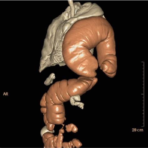3d Ct Reconstruction Download Scientific Diagram