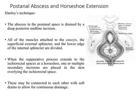 Perianal Abscess Ppt