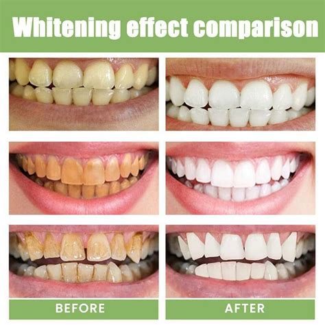 Single Use Toothpaste Packets 1 Box Of Tlopa Toothpaste Fruit