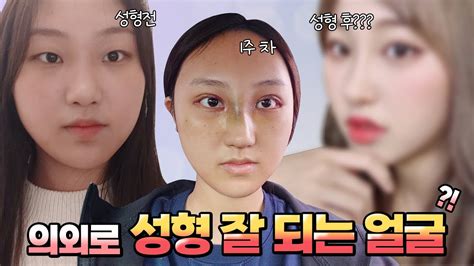행복하리 Vlog 의외로 성형하면 대박날 얼굴이라고 무쌍 뷰티유튜버 눈 코 지방이식으로 대박 도전💜 쀼 Youtube