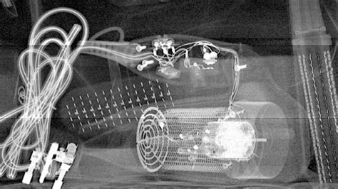 New X Ray Technique Could Help Detect Explosives Tumors Extremetech