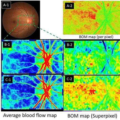 Example Of Superpixel Segmented Bom Maps Representative Maps Of