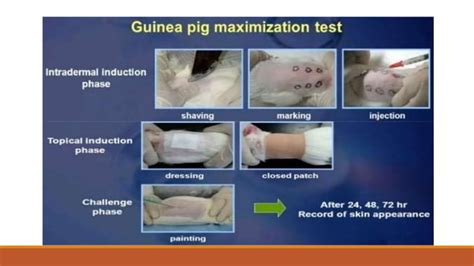 Skin Sensitisation Oecd Test Guideline 406 Pptx