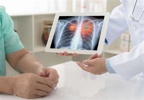 Medicare Expands Coverage Of Lcdt Lung Cancer Screening G2 Intelligence