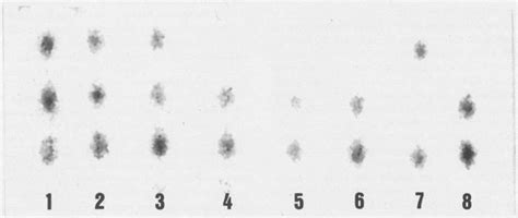 A Phosphoglucomutase Pgm Isozyme Profile Of A Cross Between Two