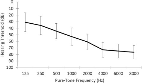 Thresholds With Errors Bars In Db Spl For Pure Tone Audiometry At 125