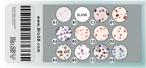 Cancer Human Cell Line Microarrays