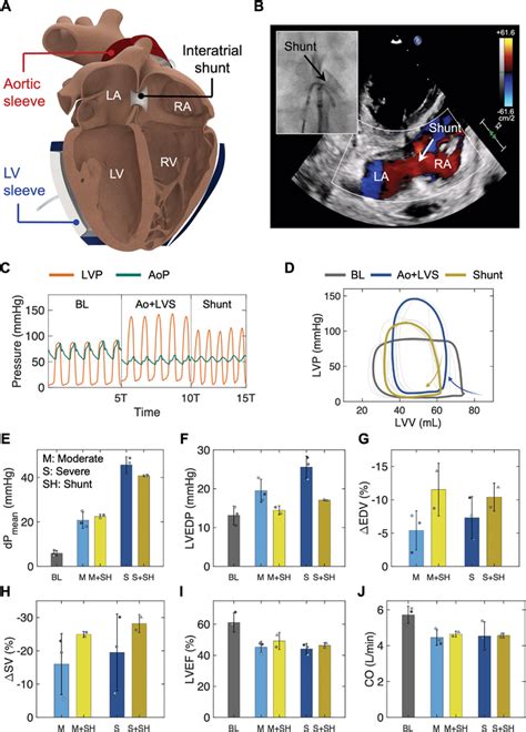 Application Of Hfpef Hemodynamic Model For Device Testing And