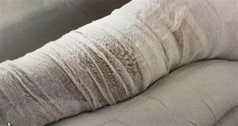 醫院開刀買一送一病人右腿受傷為麼醫生會對雙腿下刀患者可傷不起 每日頭條