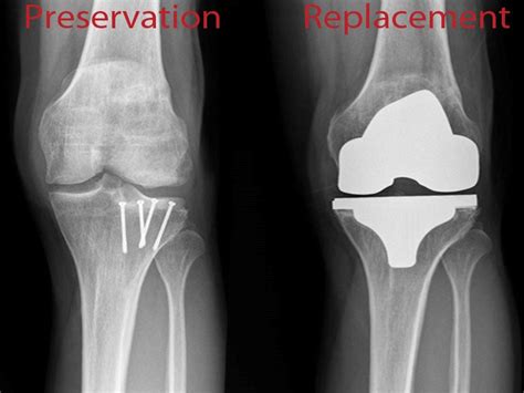 Joint Function Preservation At Robert Hambright Blog