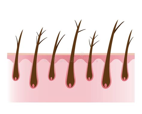 Scalp Layer Stock Illustrations 1131 Scalp Layer Stock Illustrations