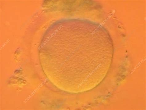 Human Fertilisation Light Microscope Stock Video Clip K005 2447