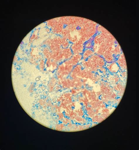 Mammal Fibrocartilage Under Microscope