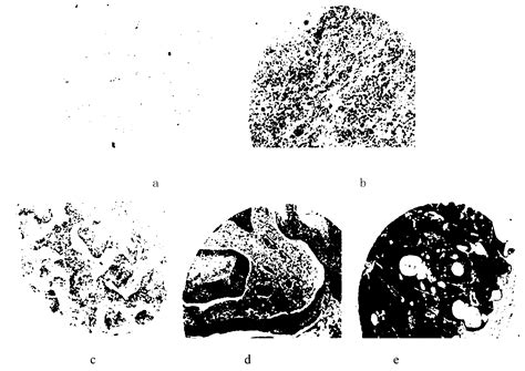 Tumor Necrosis Factor Alpha Induced Protein 8 L3 Tipe3